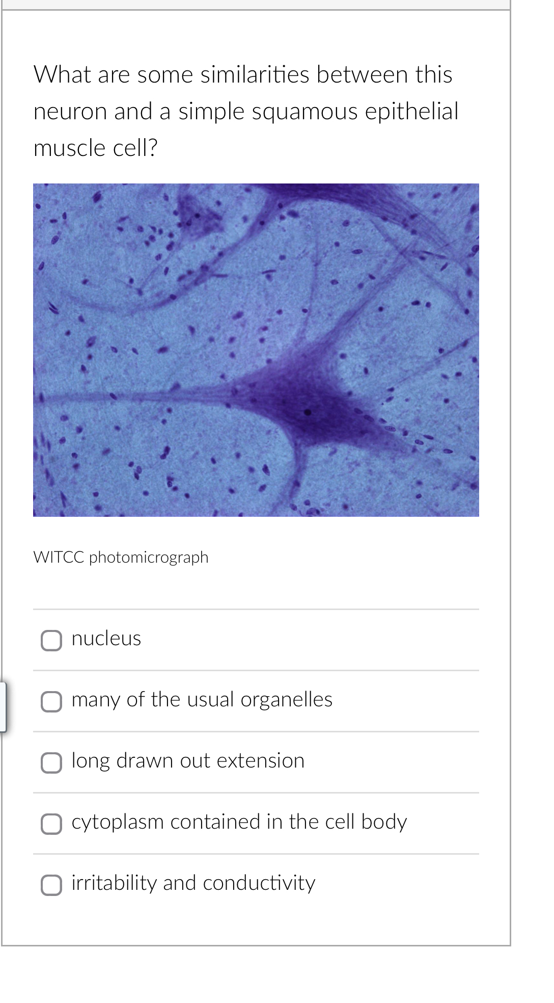 Solved What are some similarities between this neuron and a | Chegg.com