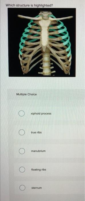 Solved Which structure is highlighted? Multiple Choice talus | Chegg.com