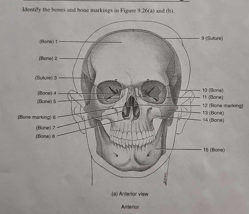 Solved Identify the bones and bone markings in Figure | Chegg.com