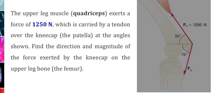 Solved The upper leg muscle (quadriceps) exerts a force of | Chegg.com