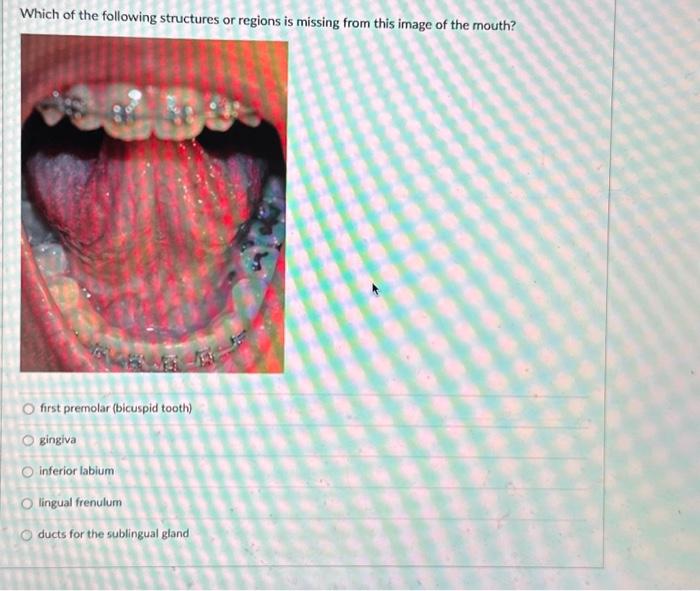 Solved Which of the following structures or regions is | Chegg.com