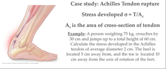 Solved Case study: Achilles Tendon ruptureStress developed | Chegg.com