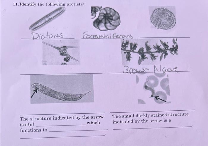 Solved 11. Identify the following protists: Diatoms | Chegg.com
