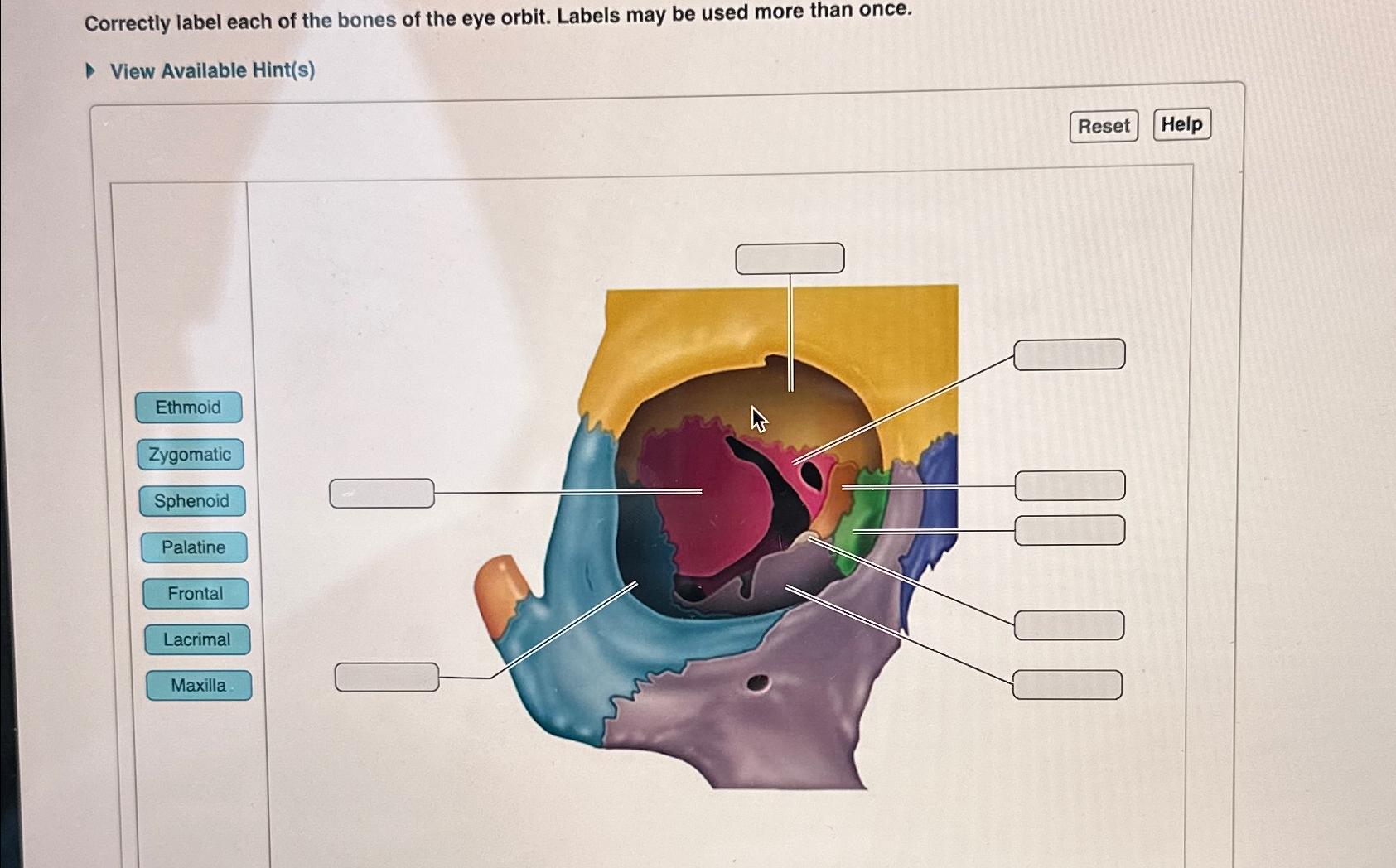 Solved Correctly label each of the bones of the eye orbit. | Chegg.com