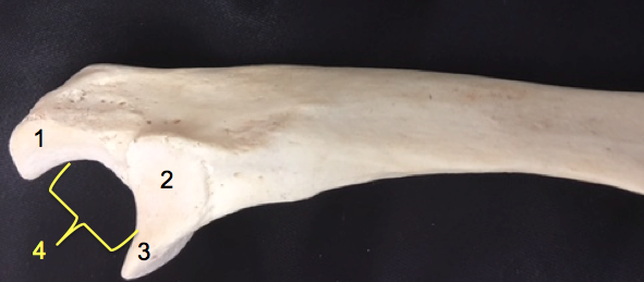 Solved What type of joint does the trochlear notch (#4) | Chegg.com