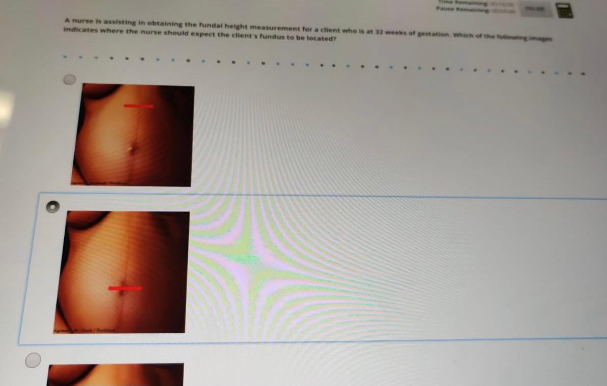 Solved PomaeA nurse is assisting in ebtaining the fundal | Chegg.com