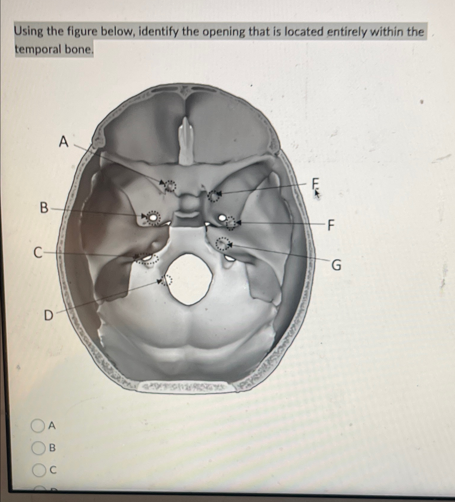 Solved Using the figure below, identify the opening that is | Chegg.com