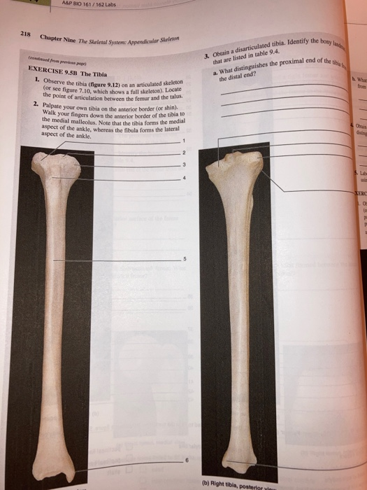 Solved 3. Orain a disarticulated tibia. Identify the boty a. | Chegg.com