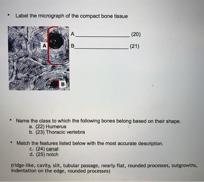 Solved Label the micrograph of the compact bone tissue А. | Chegg.com