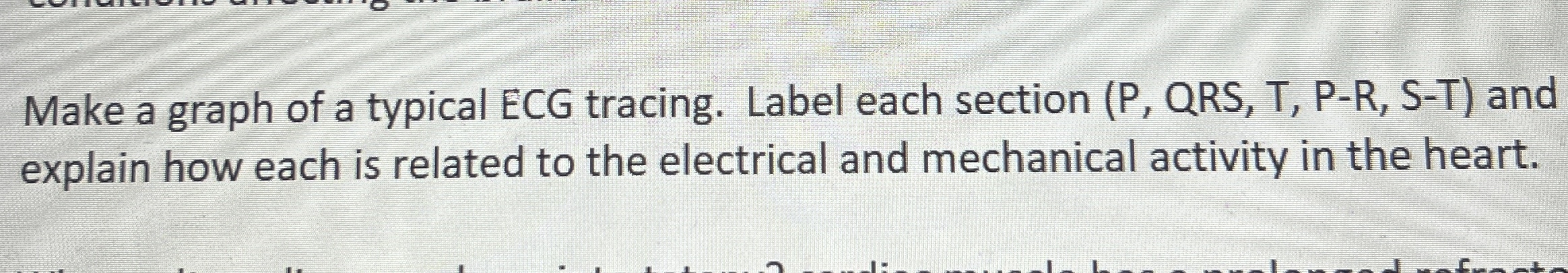 Solved Make a graph of a typical ECG tracing. Label each | Chegg.com