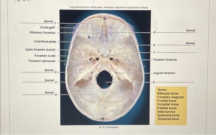 Solved (bone) 1 - Crista galli - Olfactory foramina - | Chegg.com