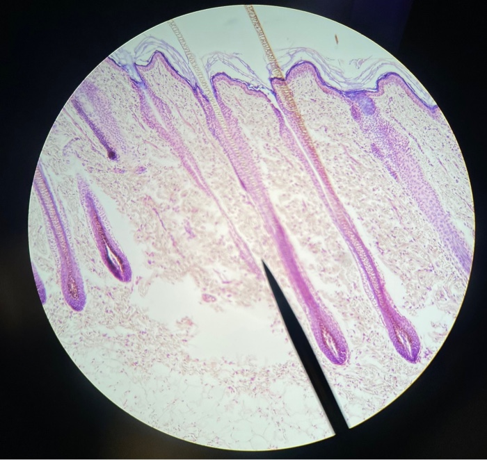 Solved 9label: hair root, hair shaft, hair bulb, hair | Chegg.com