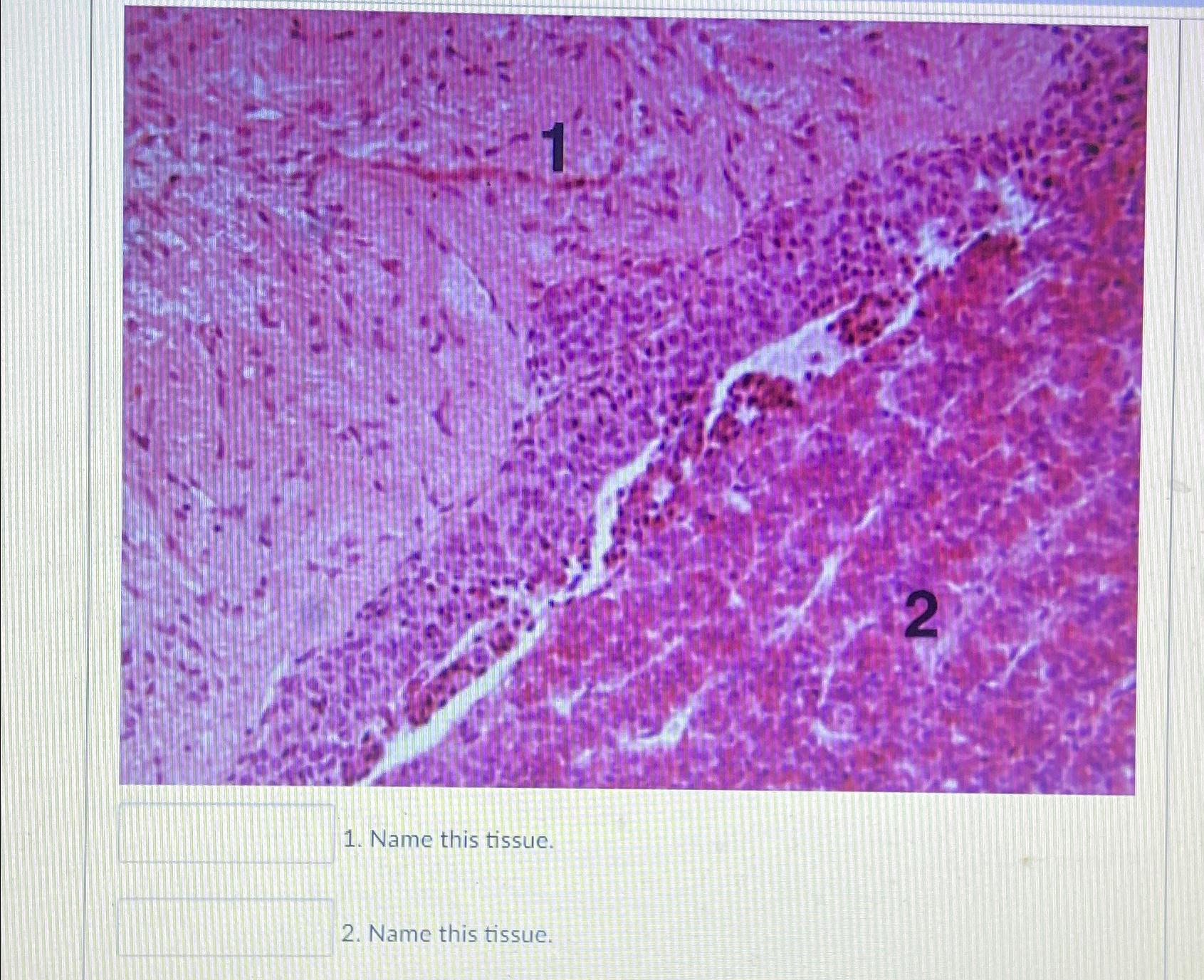 Solved Name this tissue.Name this tissue. | Chegg.com
