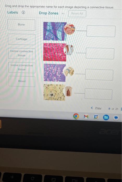 Solved Drag and drop the appropriate name for each image | Chegg.com