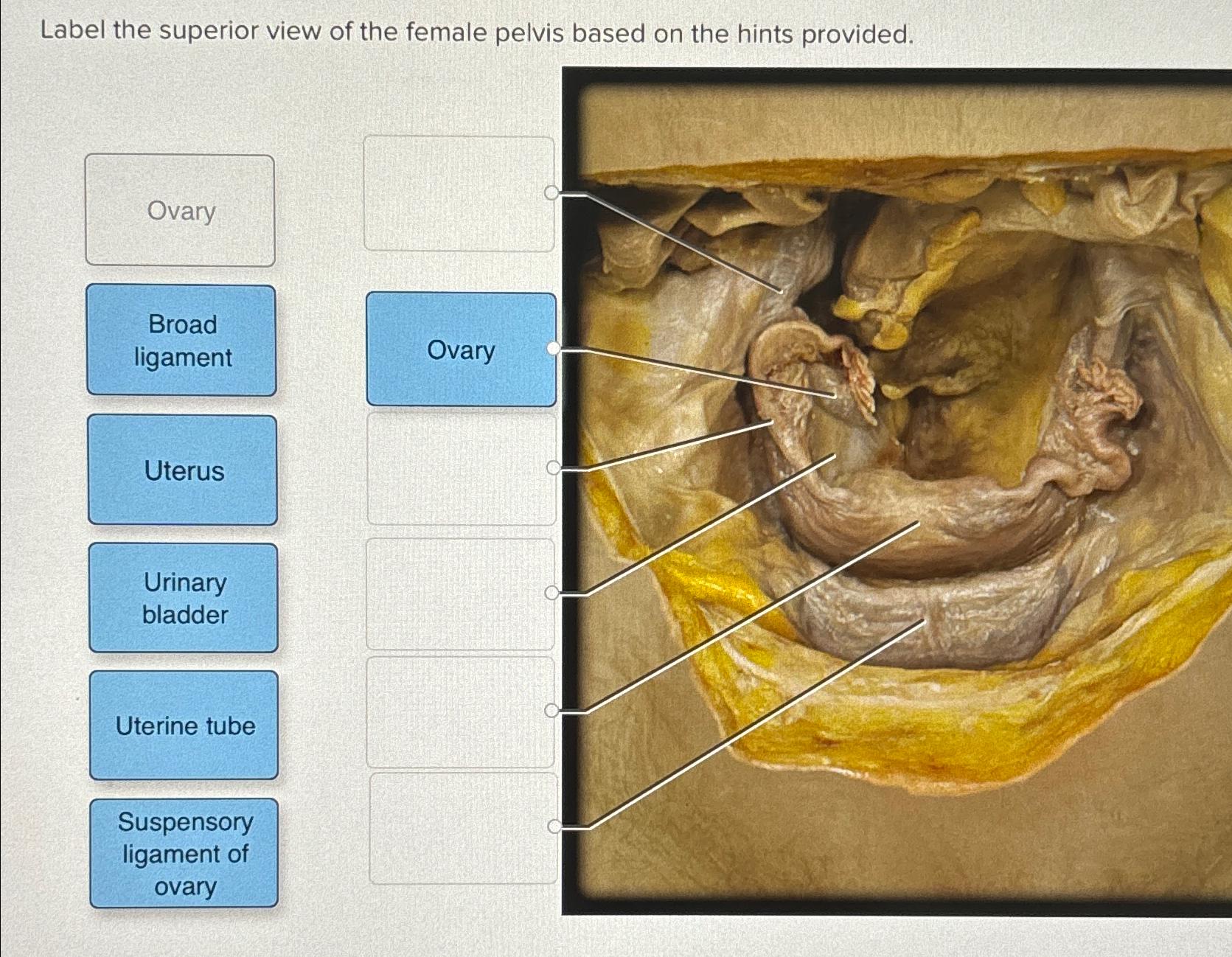 Solved Label the superior view of the female pelvis based on | Chegg.com