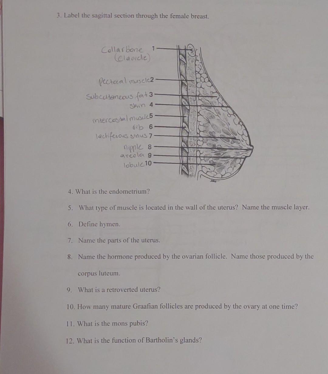 Solved 3. Label the sagittal section through the female | Chegg.com
