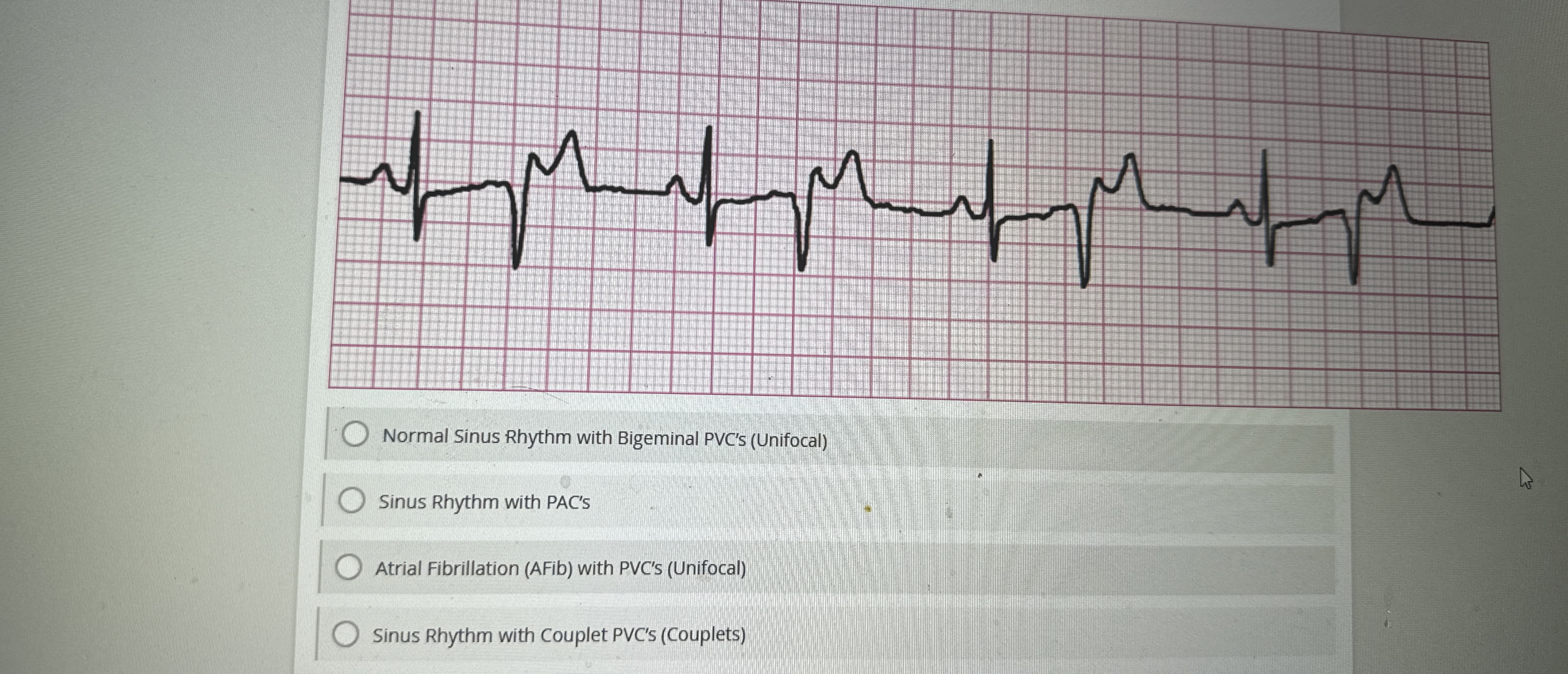 Solved Identify the Rhythm: ﻿Normal Sinus Rhythm with | Chegg.com