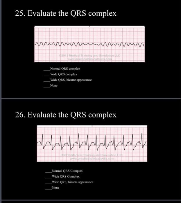 Solved 25. Evaluate the QRS complex vnnummins Normal QRS | Chegg.com