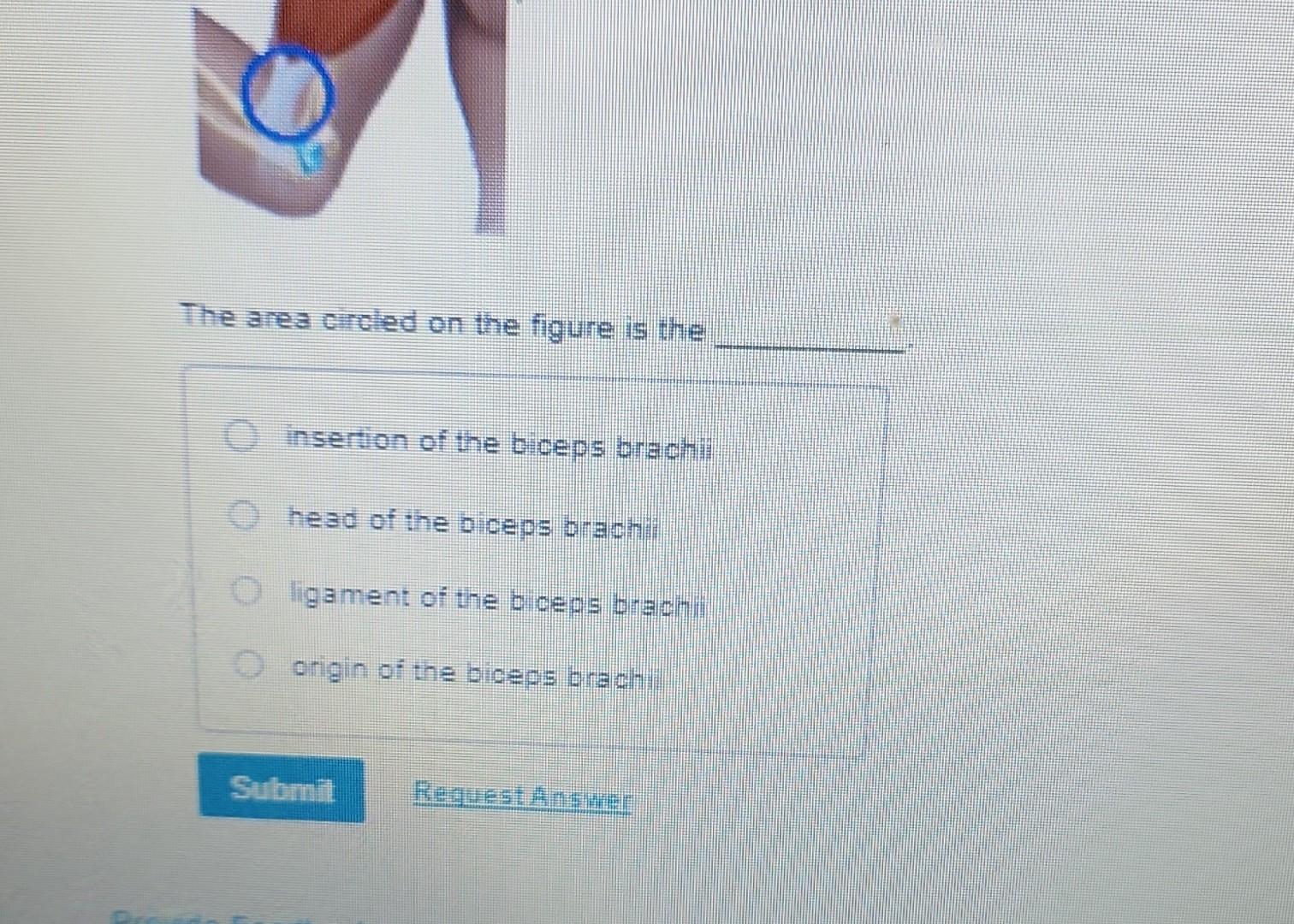 the area circled on the figure is the | Chegg.com