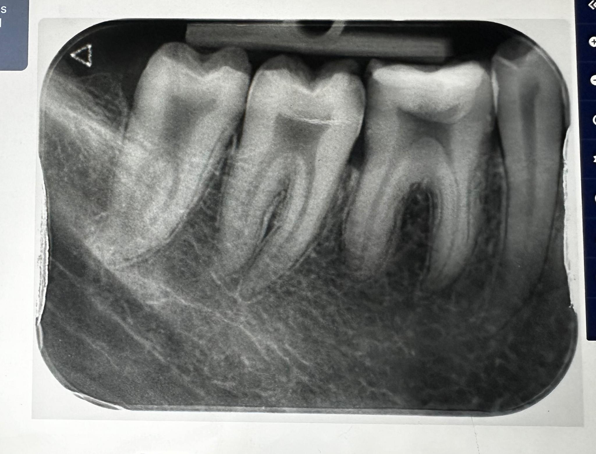Solved Please draw the anatomical landmarks and dental | Chegg.com