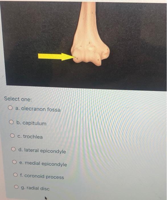 Solved hed Select one: O a. olecranon fossa O b. capitulum O | Chegg.com