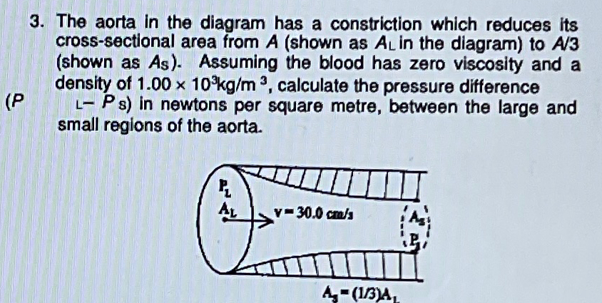 Solved The aorta in the diagram has a constriction which | Chegg.com
