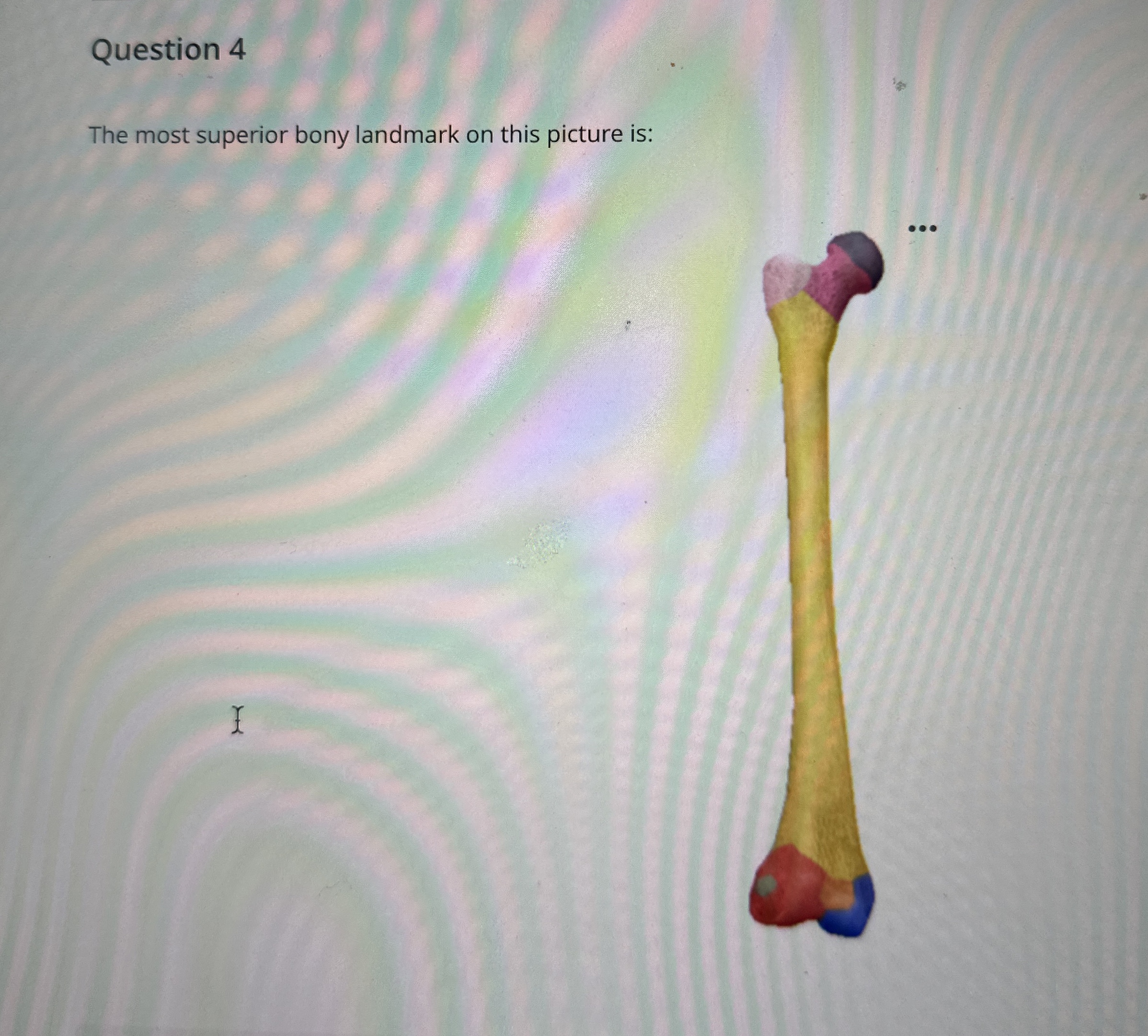 Solved Question 4The most superior bony landmark on this | Chegg.com