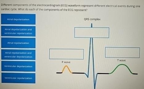Solved Different components of the electrocardiogram (ECG) | Chegg.com