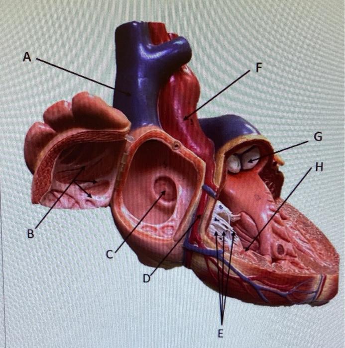 Solved A F G H B D Identify the blood vessel labeled A. | Chegg.com