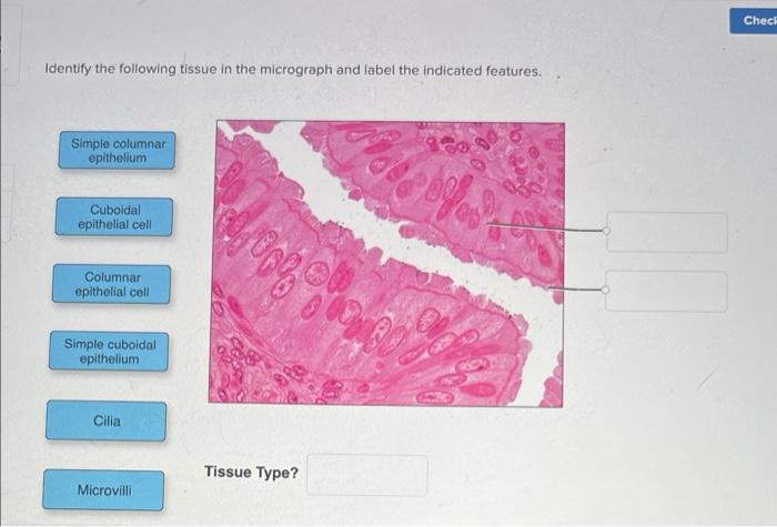 Identify the following tissue in the micrograph and | Chegg.com