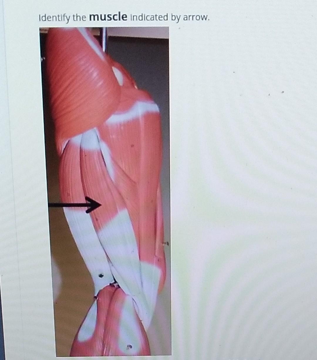 Solved Identify the muscle indicated by arrow. QUESTION 19 | Chegg.com