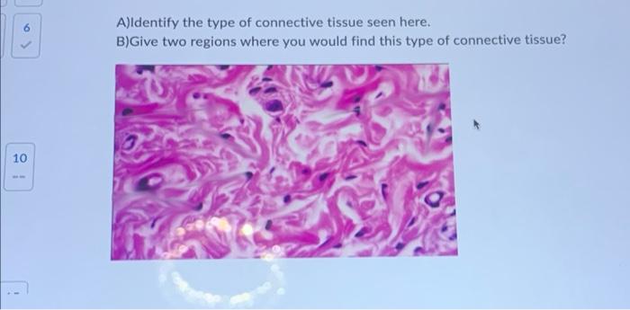 Solved A)Identify the type of connective tissue seen here. | Chegg.com