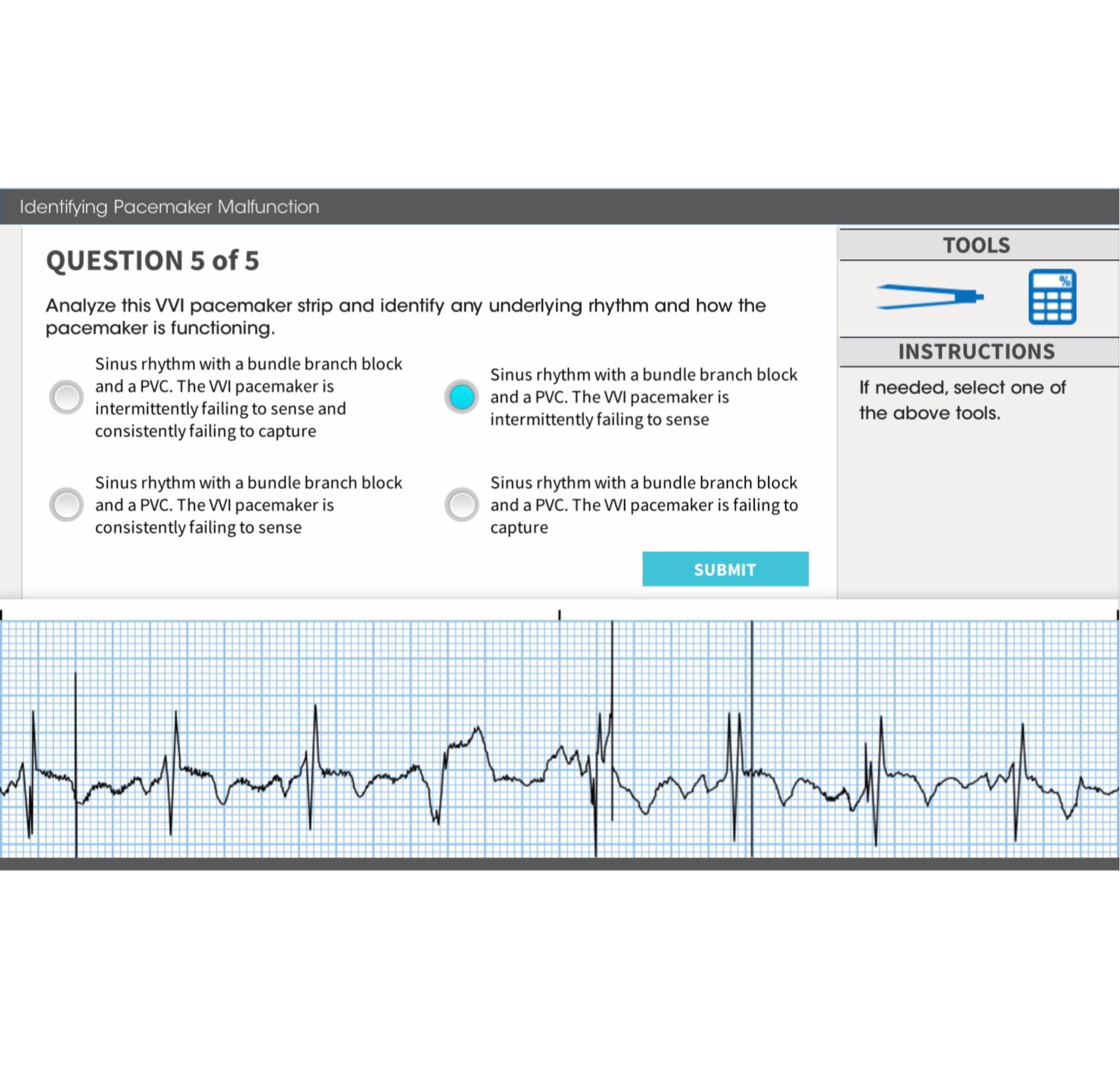 Solved Identifying Pacemaker MalfunctionQUESTION 5 ﻿of | Chegg.com