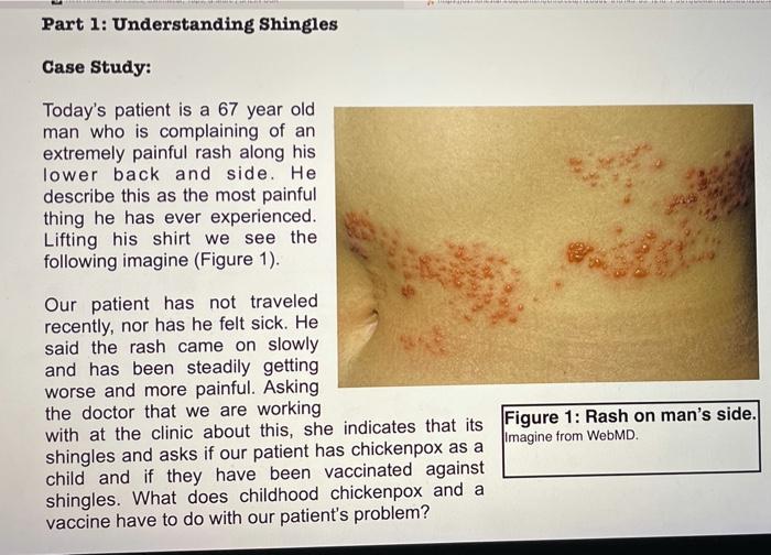 Solved Part 1: Understanding Shingles Case Study: Today's | Chegg.com