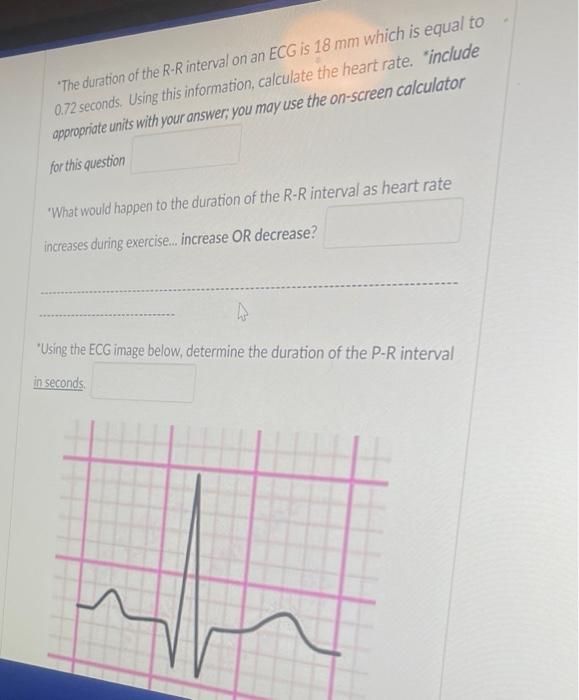 Solved *The duration of the R-R interval on an ECG is 18 mm | Chegg.com