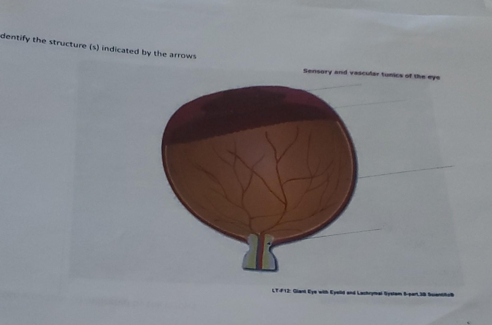 Solved dentify the structure (s) indicated by the arrows | Chegg.com