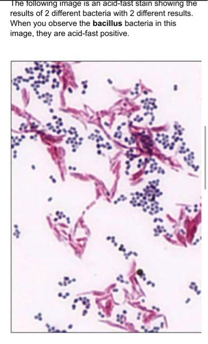 Solved The following image is an acid-fast stain showing the | Chegg.com