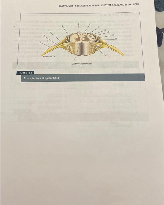 Solved SECTION 3: SPINAL CORD AND SPINAL NERVES A. The | Chegg.com