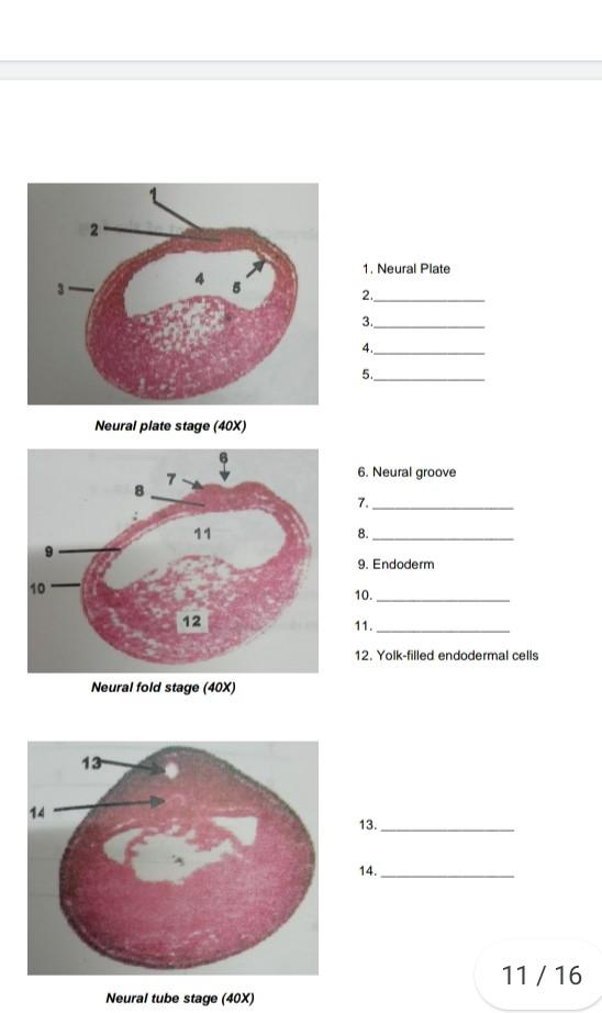 Solved 2 1. Neural Plate 2. 3. 4. 5. Neural plate stage | Chegg.com