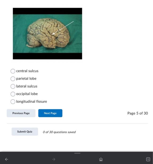 Solved central sulcus parietal lobe lateral sulcus occipital | Chegg.com