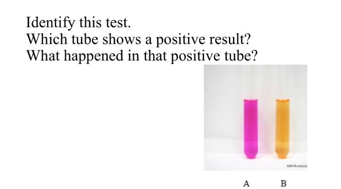 Solved Identify this test. Which tube shows a positive | Chegg.com