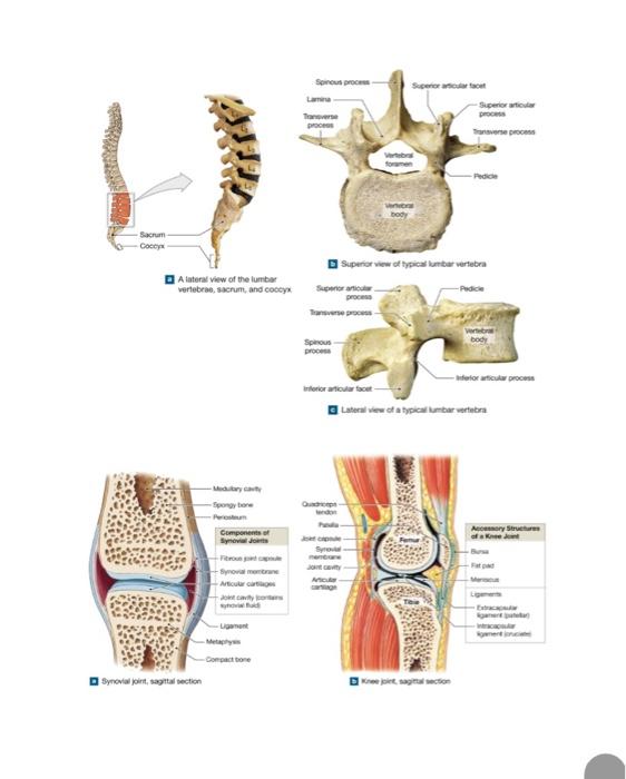 Solved Osteon Lacunae Central canal Lamellae Osteons SEM X | Chegg.com
