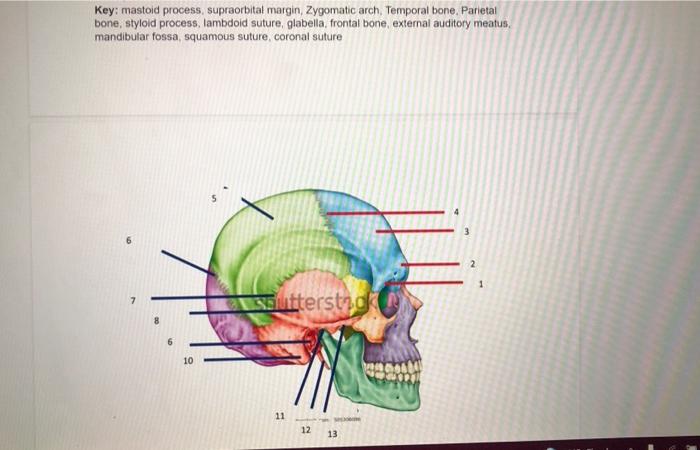 Solved Key: mastoid process, supraorbital margin Zygomatic | Chegg.com