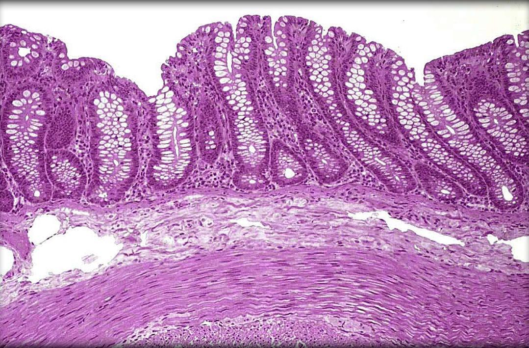 Solved Using the histology slide below of the Large | Chegg.com