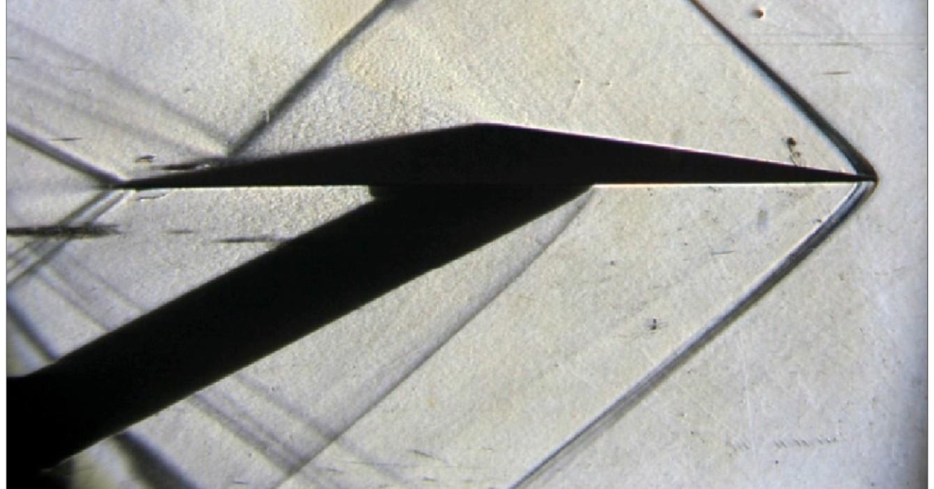 Please use the shileran pitcutre bellow to mark the | Chegg.com