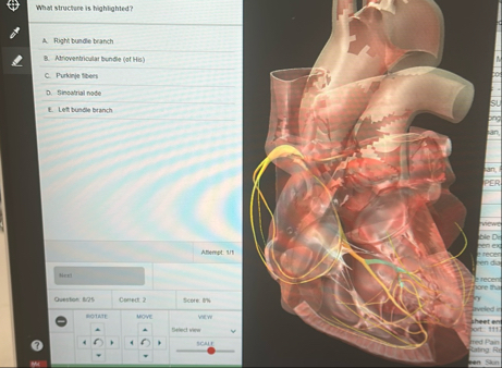 Solved What structure is highlighted?A. ﻿Right bunde | Chegg.com