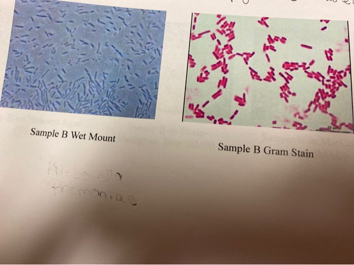 Solved Sample B Wet Mount Sample B Gram Stain ena Sample B | Chegg.com