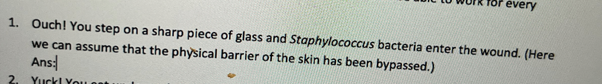 Solved Ouch! You step on a sharp piece of glass and | Chegg.com