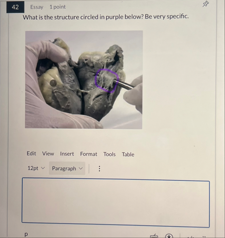 42Essay 1 ﻿pointWhat is the structure circled in | Chegg.com
