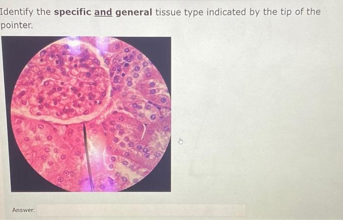 Solved Identify the specific and general tissue type | Chegg.com